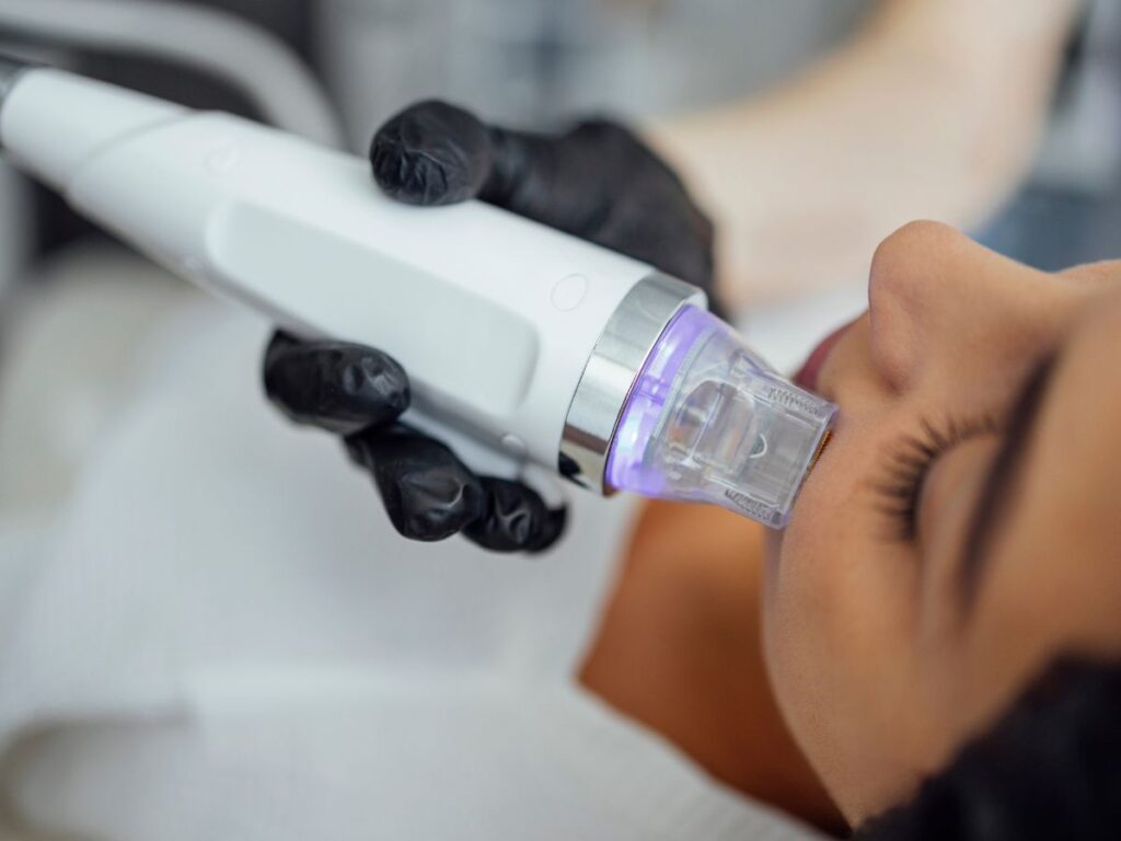 What Is RF Microneedling? Benefits & How It Works